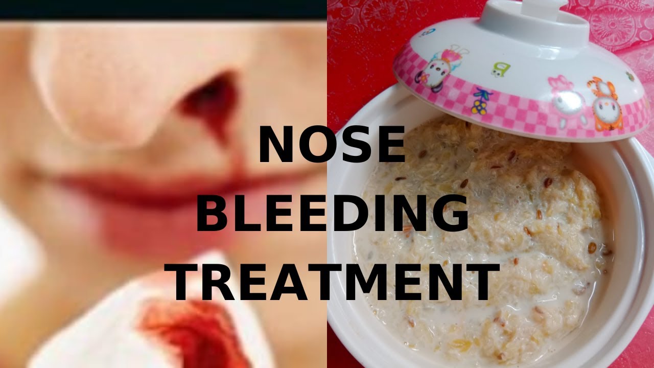 Nose bleeding treatment | Nakseer Phootna Ka ilaj |desitotkay - YouTube