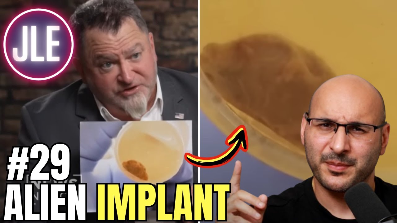 'Alien Implant' Footage Just Released to the Public ! - YouTube