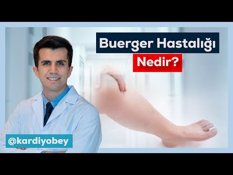 Sigara İçmenin Gizli Tehlikesi: Buerger Hastalığı Nedir?