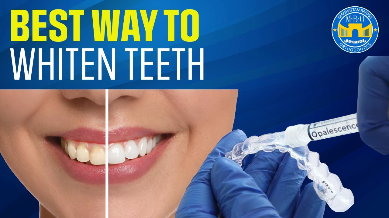 BEST Way to Whiten Teeth with Aligners or Retainers - YouTube