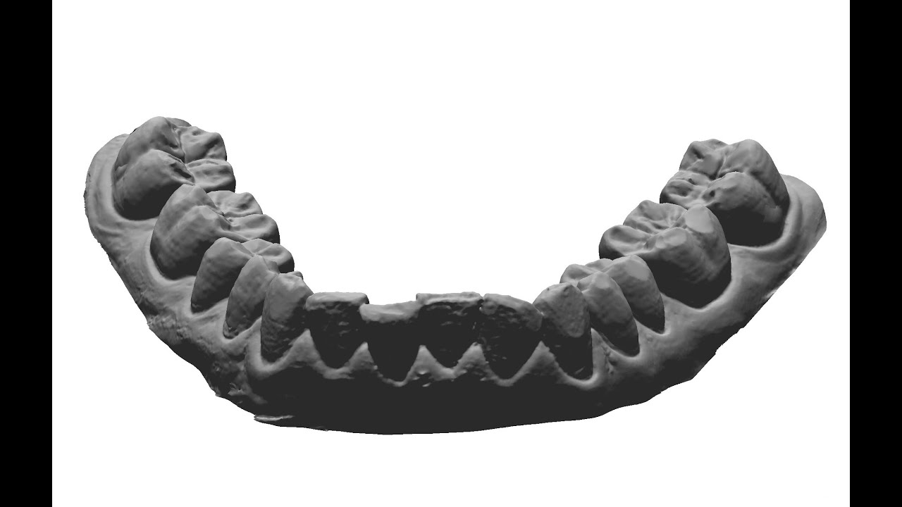 Windows Grayscale Color Filter Tutorial for Exocad Morphology Mode ...