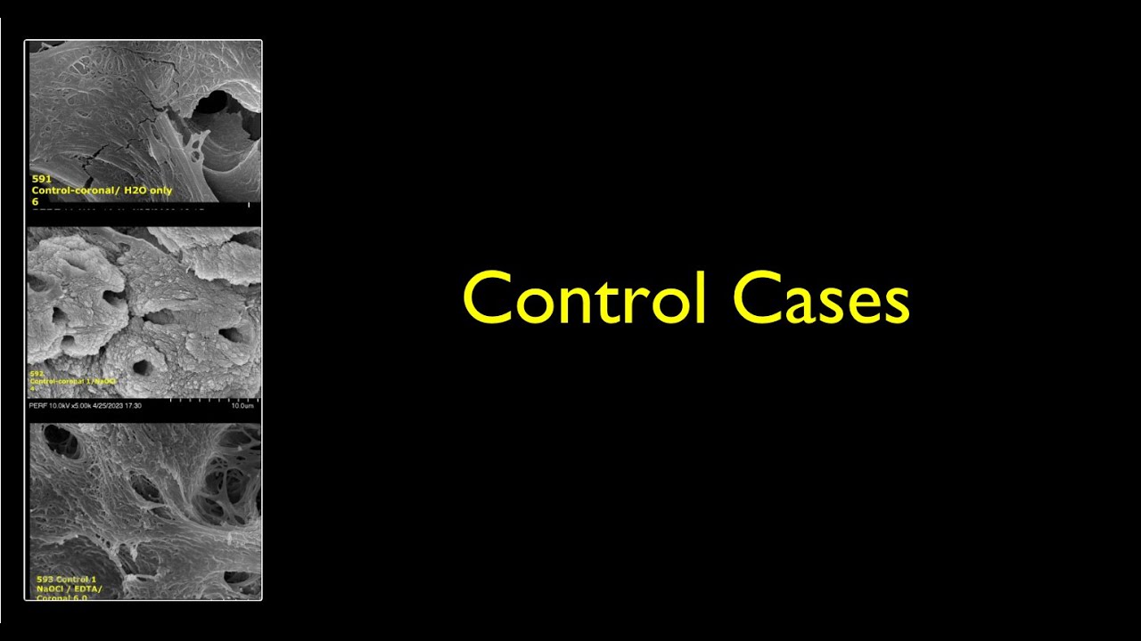 Final Control Cases Presentation - YouTube