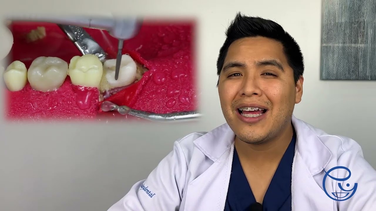 [En 𝐕𝐈𝐕𝐎🔴] PASO a PASO 𝗘𝗫𝗧𝗥𝗔𝗖𝗖𝗜Ó𝗡 𝗠𝗨𝗘𝗟𝗔 𝗗𝗘𝗟 𝗝𝗨𝗜𝗖𝗜𝗢 - YouTube