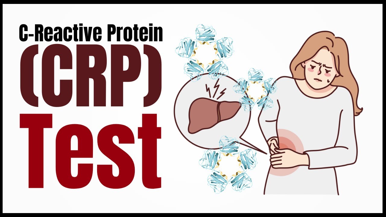 C-Reactive Protein (CRP) Test Explained: Principle, Procedure & Uses in ...