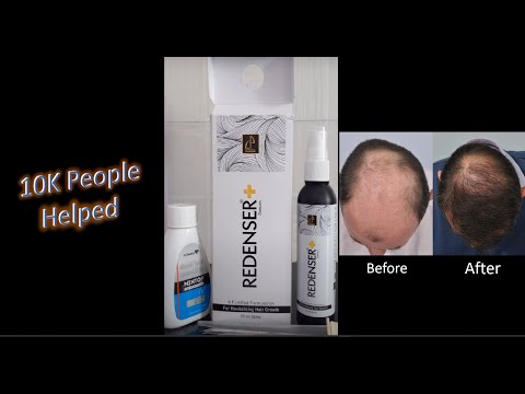 REDENSER or REDENSER+ Hair Serum for Hairfall. What is REDENSYL. - YouTube