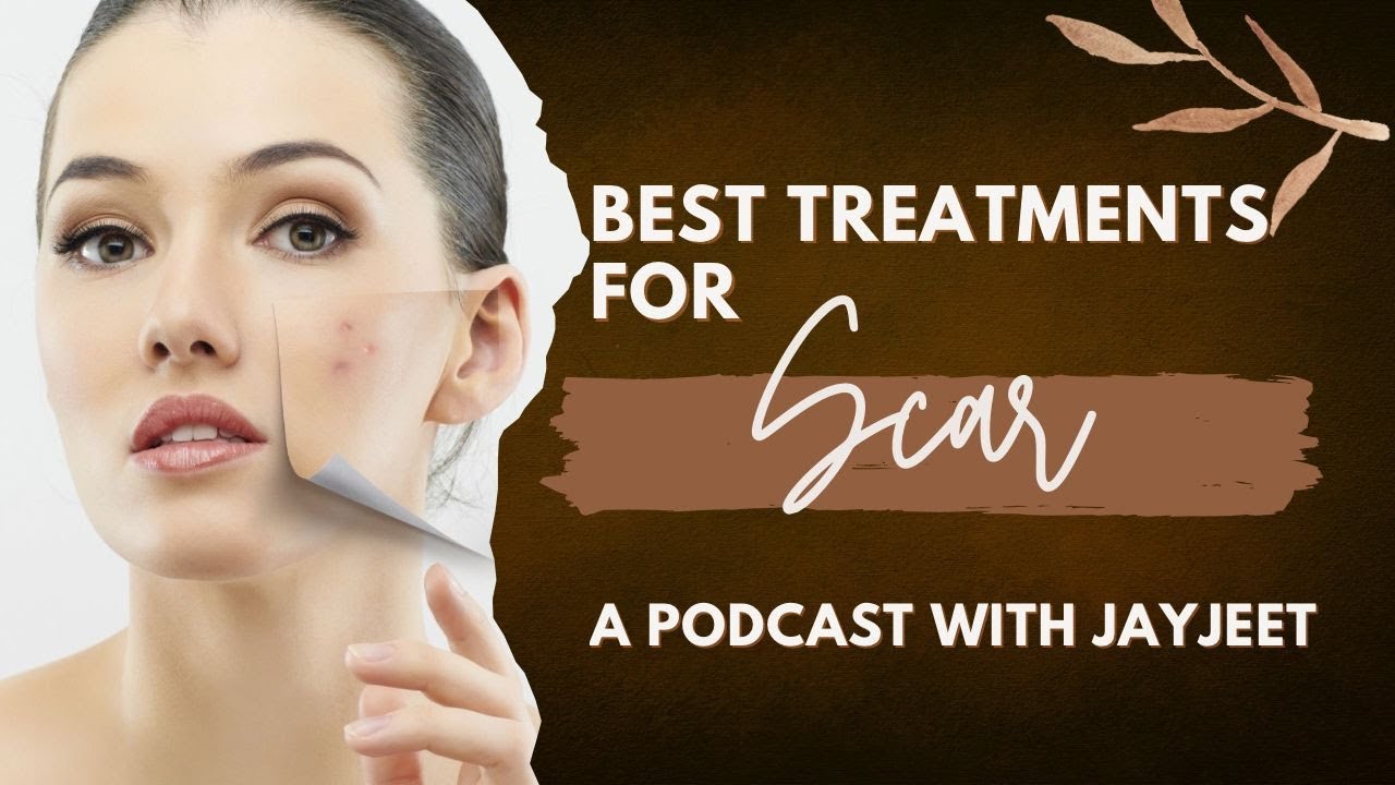BEAUTY BATTLE EP-4 ( REASON OF ACNE SCARS & DIFFRENT TYPES OF SCARS ...