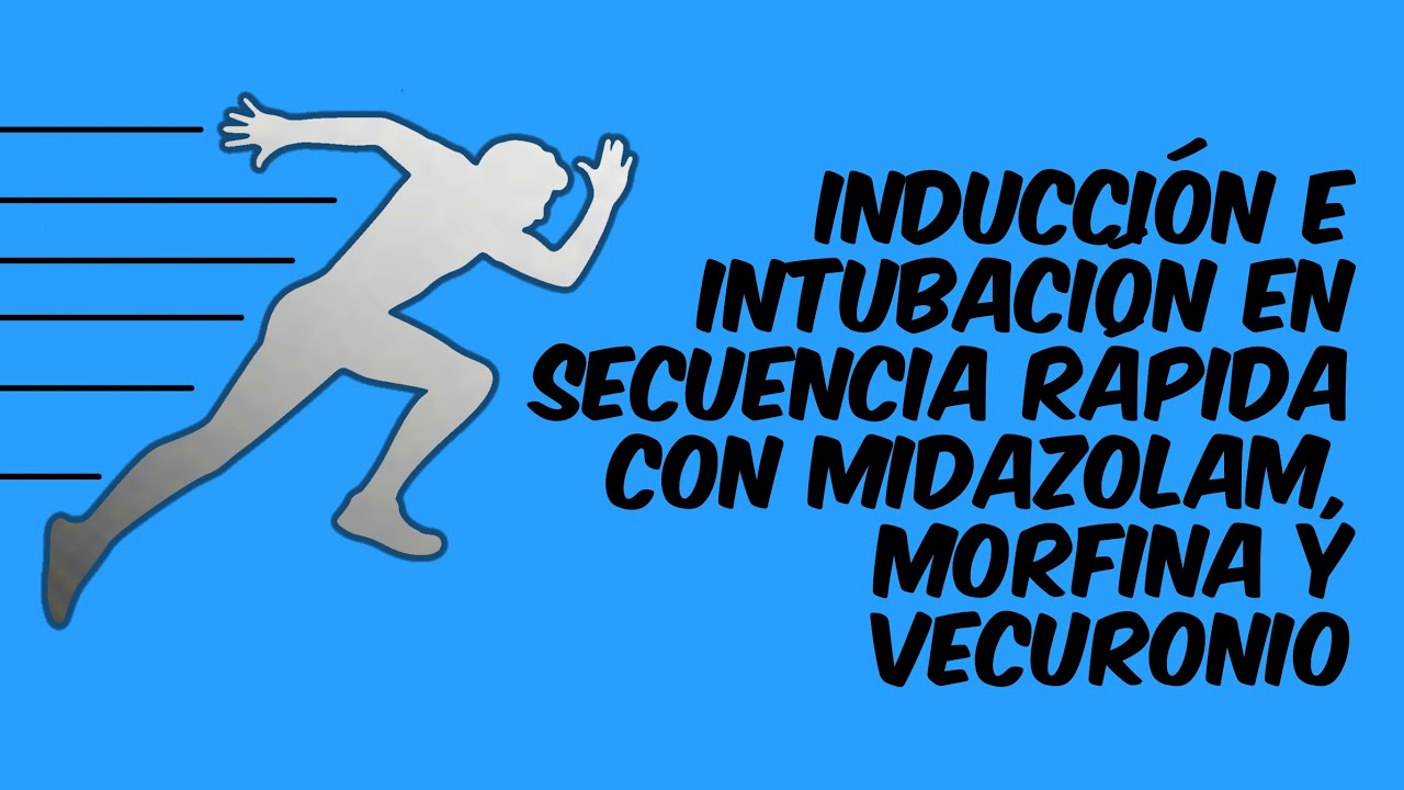 ¿Se puede hacer una inducción e intubación en secuencia rápida con ...