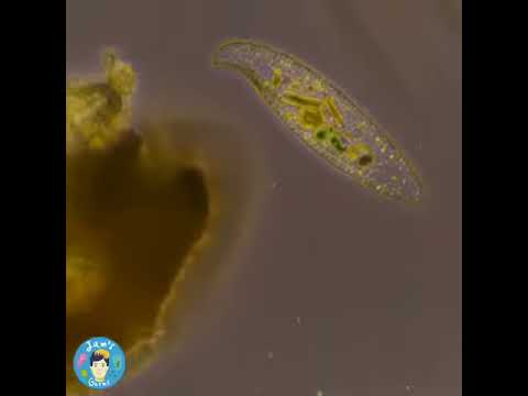 This is a single-celled organism, Loxodes ciliates! - YouTube