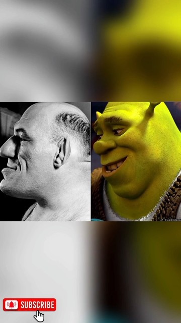 acromegaly || real life shrek #shortsfeed #shorts #trending #explore # ...