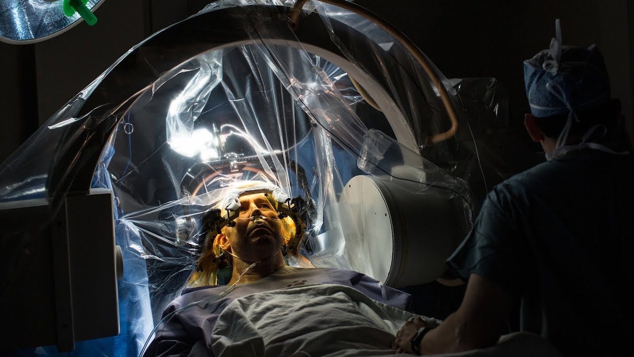 How to choose the right DBS device - YouTube