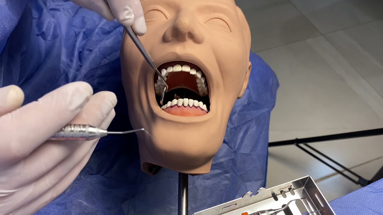 Video parte I: Pre clinica posición operador-tratamiento periodontal ...