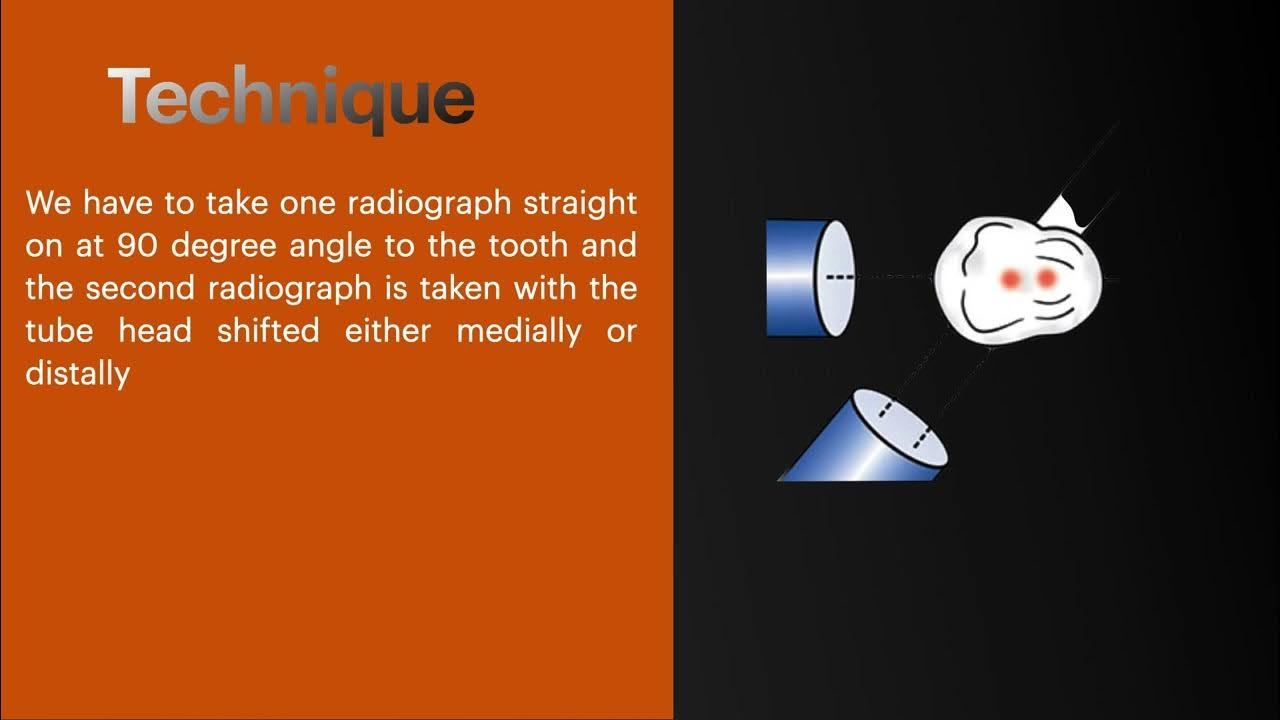 SLOB Technique, Radiographic technique - YouTube