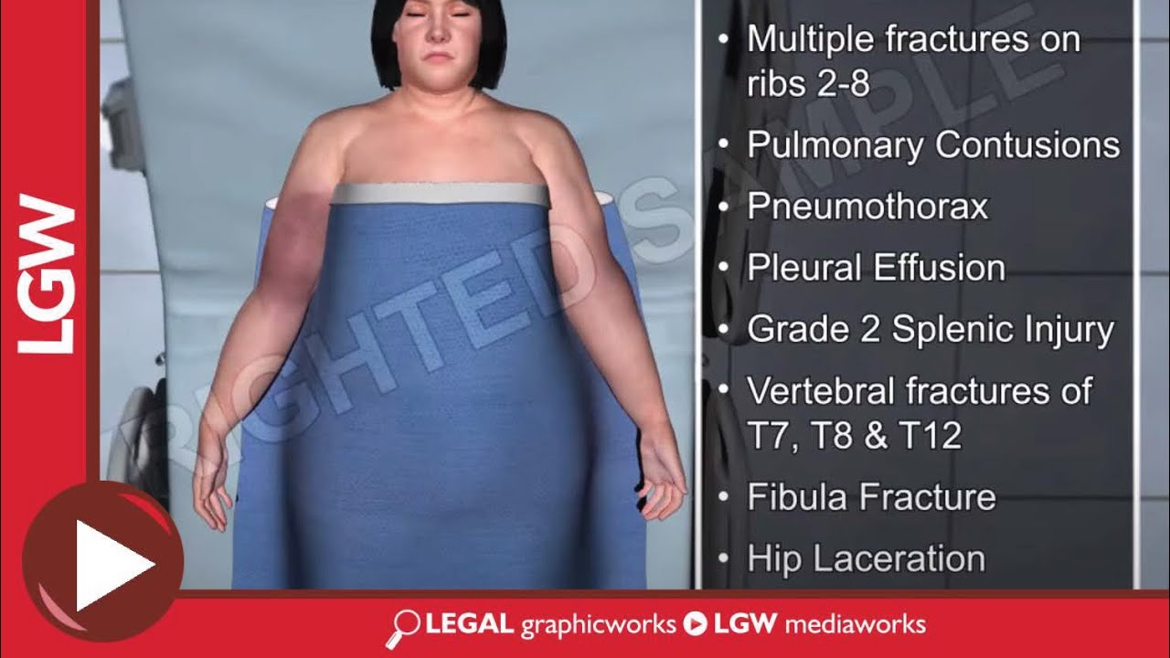 Injury Summary 3D Animation - YouTube