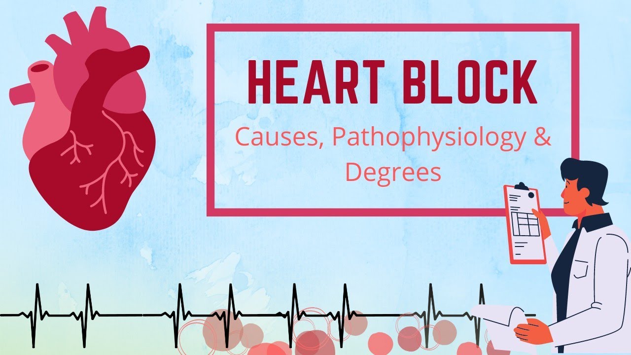 Heart Block- Part1 //Causes, mechanism,Degrees & symptoms - YouTube