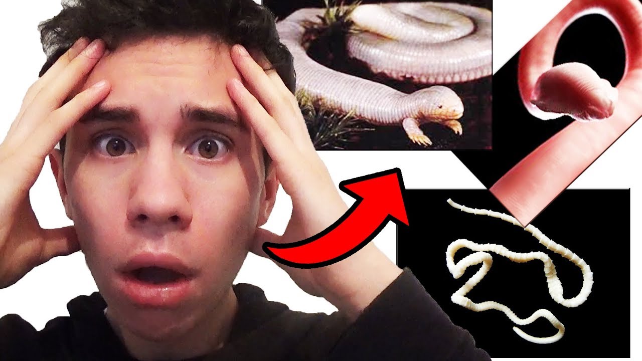J'AI ATTRAPÉ UN VER SOLITAIRE DANS MON CORPS ! - YouTube