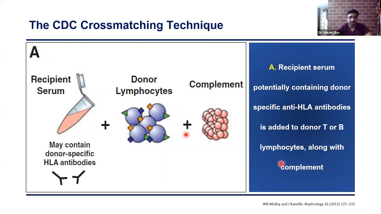 A SIMPLE GUIDE TOWARDS UNDERSTANDING PRE TRANSPLANT CROSS MATCH - YouTube