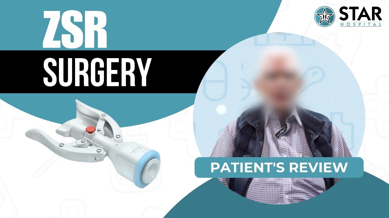 Stapler Circumcision ZSR surgery Jalandhar | Best Hospital Latest ...