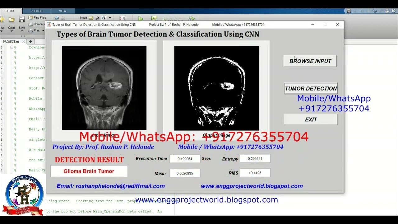 Types of Brain Tumor Detection Using CNN Matlab Project With Source Code Brain Tumor ...