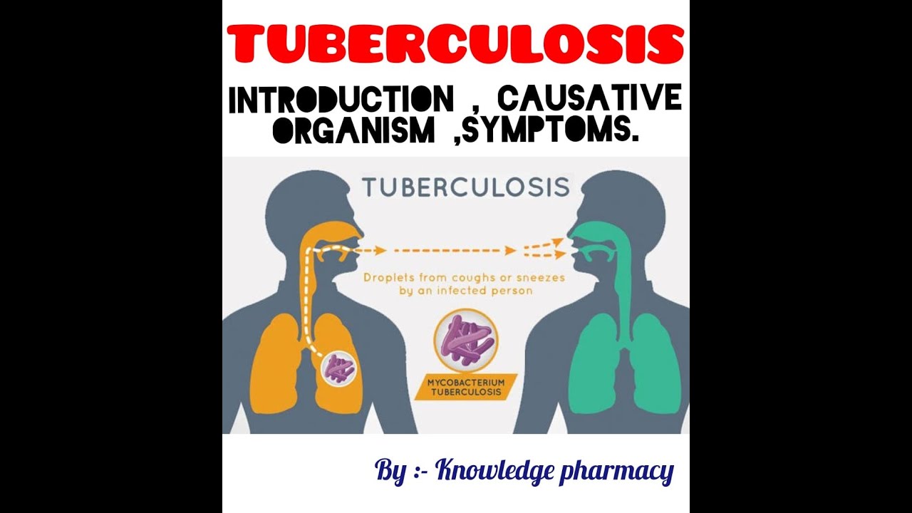 TUBERCULOSIS , SIGN & SYMPTOMS . TB , TEST , MANTOUX TEST , PHARMACY ...