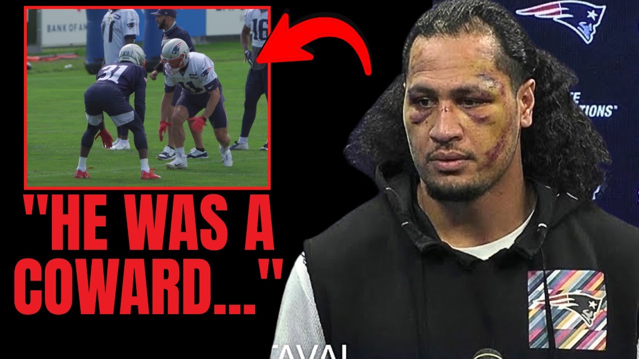 “HE WAS A COWARD”: Jahlani Tavai shows facial bruise and ERUPTS in ...