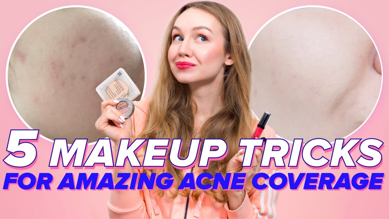 5 Makeup Tricks For Acne (how to cover acne marks and feel comfortable ...