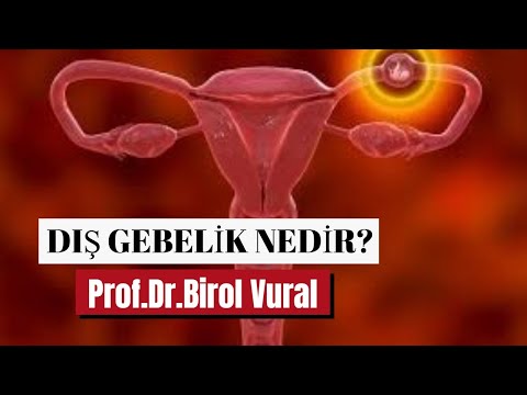 Dış gebelik nedir, belirtileri nelerdir? Dış gebelik hakkında merak edilenler