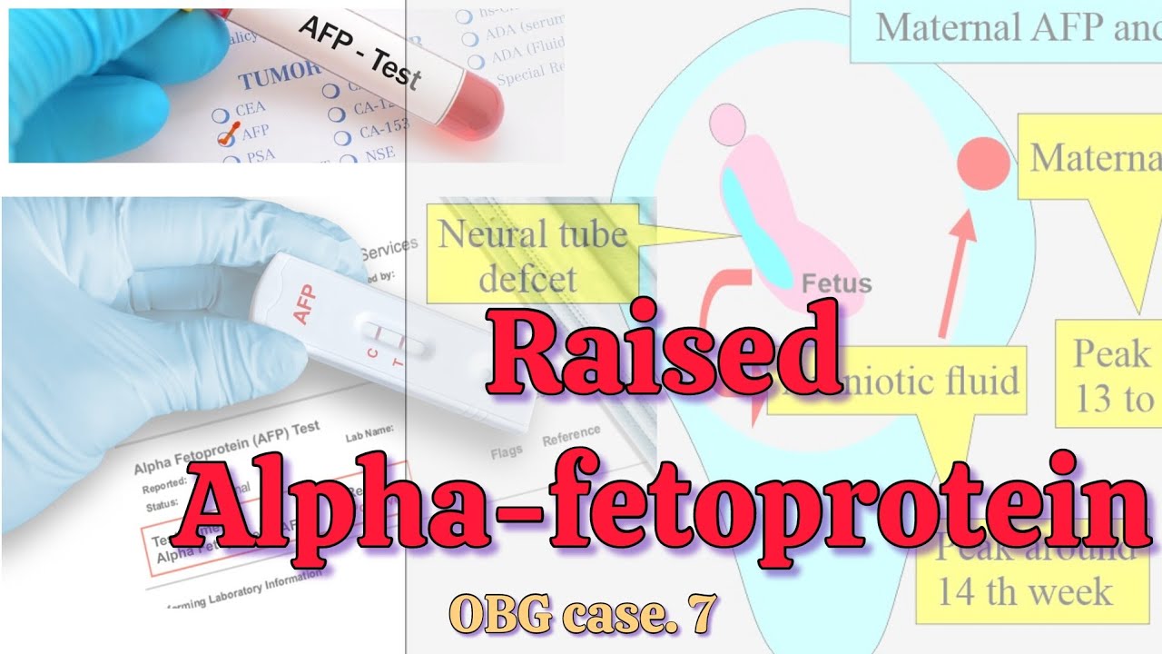 Raised Alpha-fetoprotein | #OBG_case_7 | - YouTube