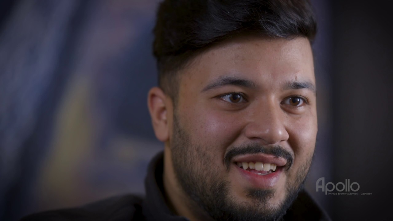 Why Apollo Is The Highest Rated Hair Restoration Center In Houston ...