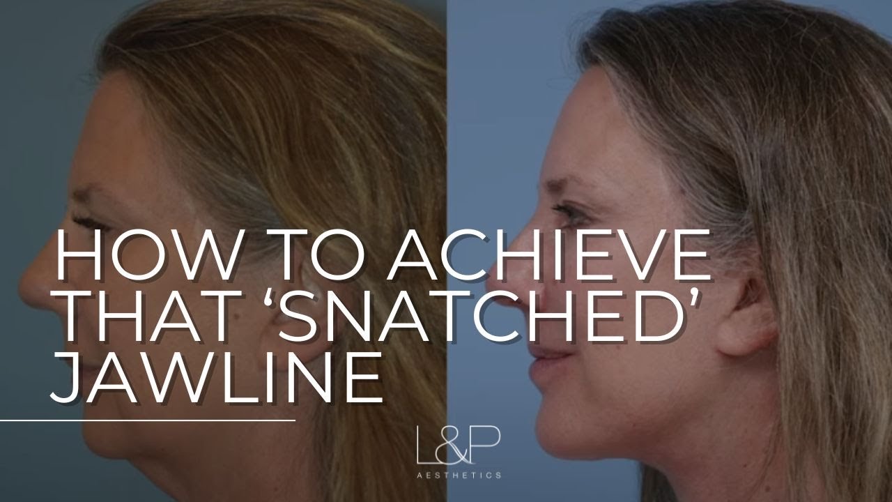 How To Achieve That Snatched Jawline | Palo Alto, CA - YouTube