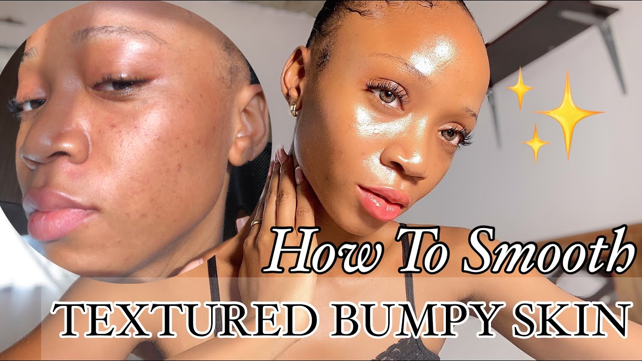 How to Get Rid & Smoothen TEXTURED , BUMPY Skin | #dryskin # ...