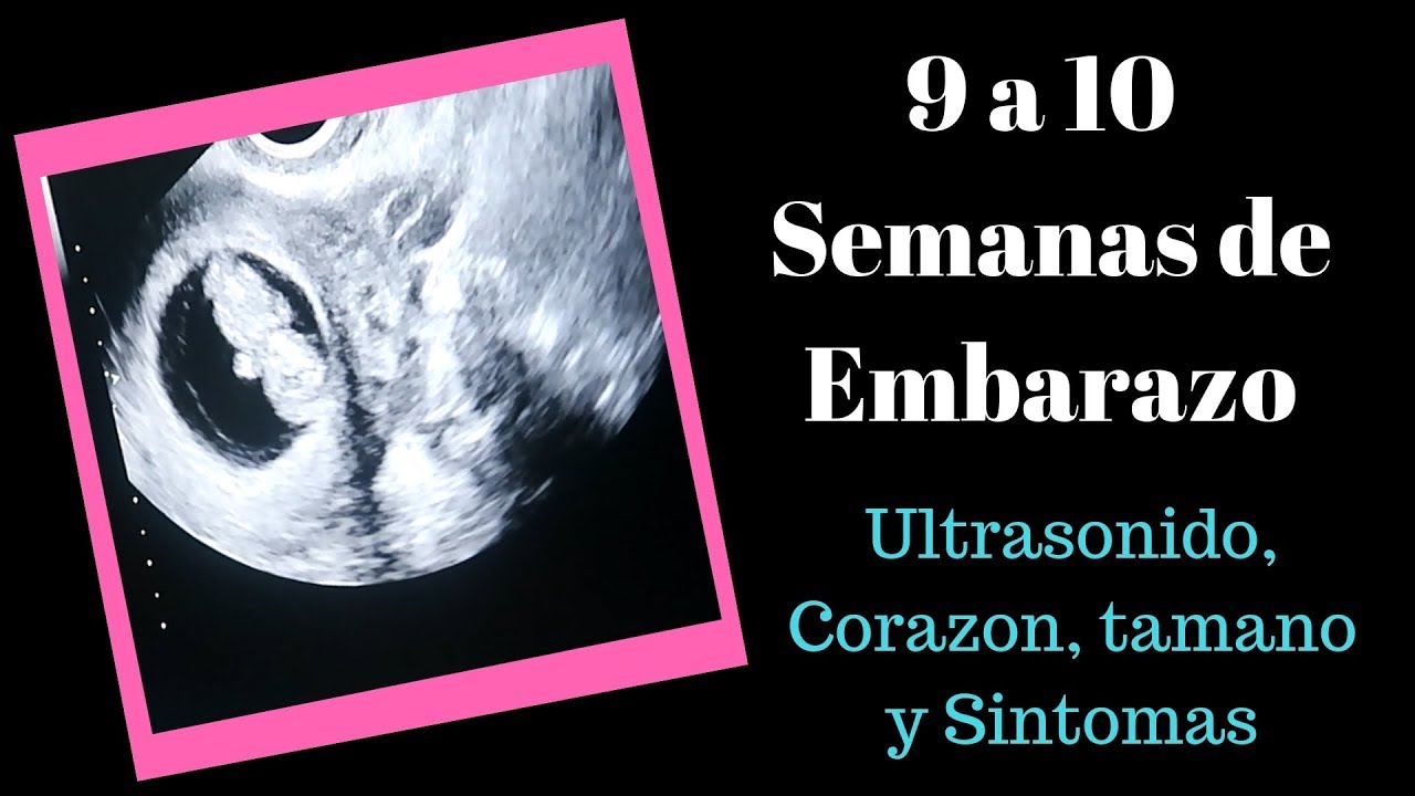9 a 10 Semanas de Embarazo / El Bebe Ya se Mueve ! / Vlog - Mi Cepeda ...