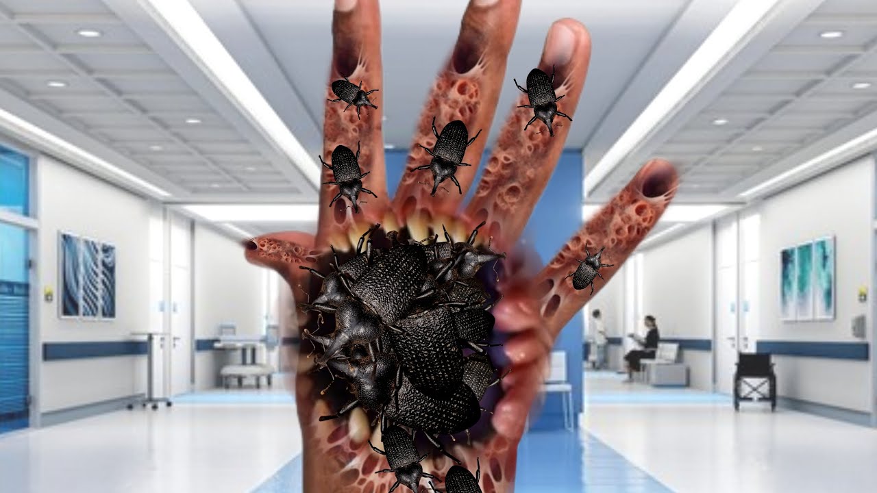 ASMR | Back side hand palm neat clean treatment in animation relaxing ...