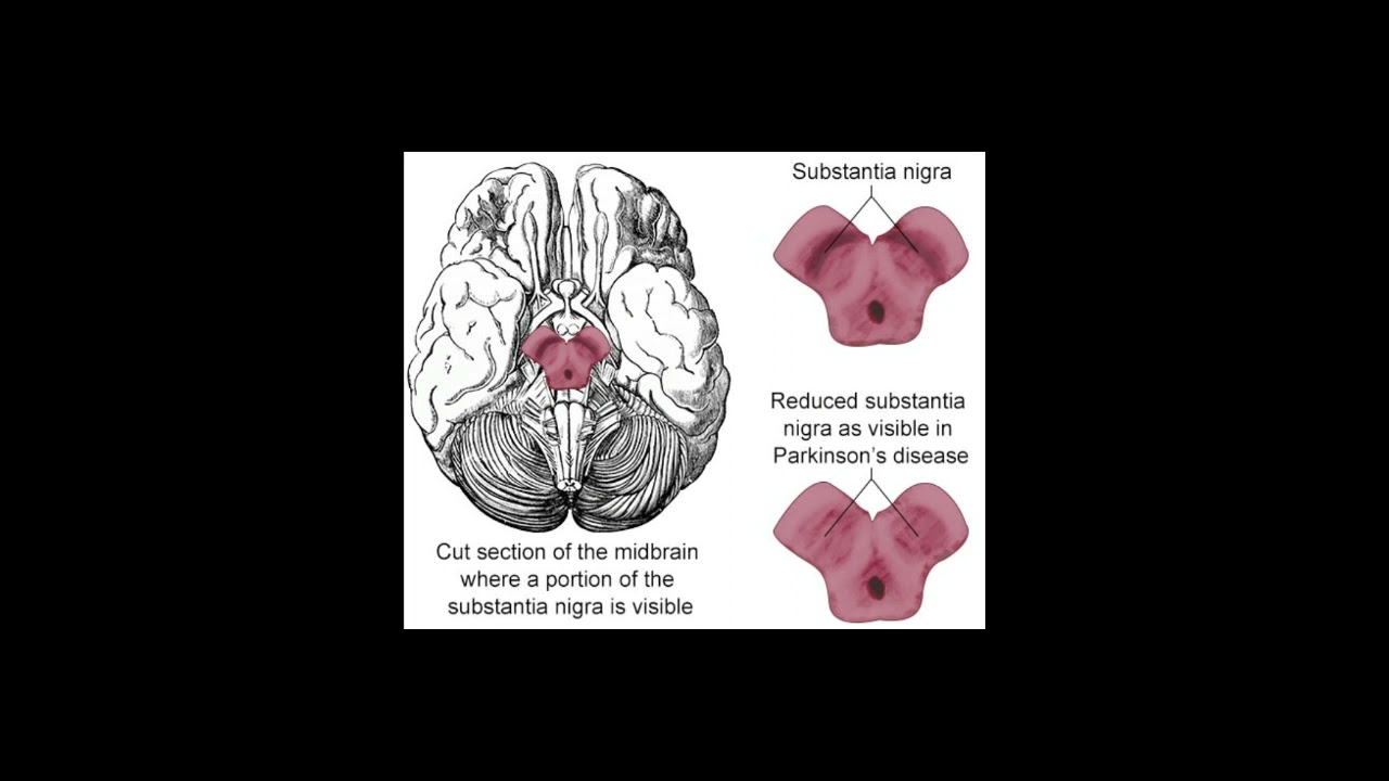 Function and Location of Substantia Nigra A Diagrammatic Explanation ...