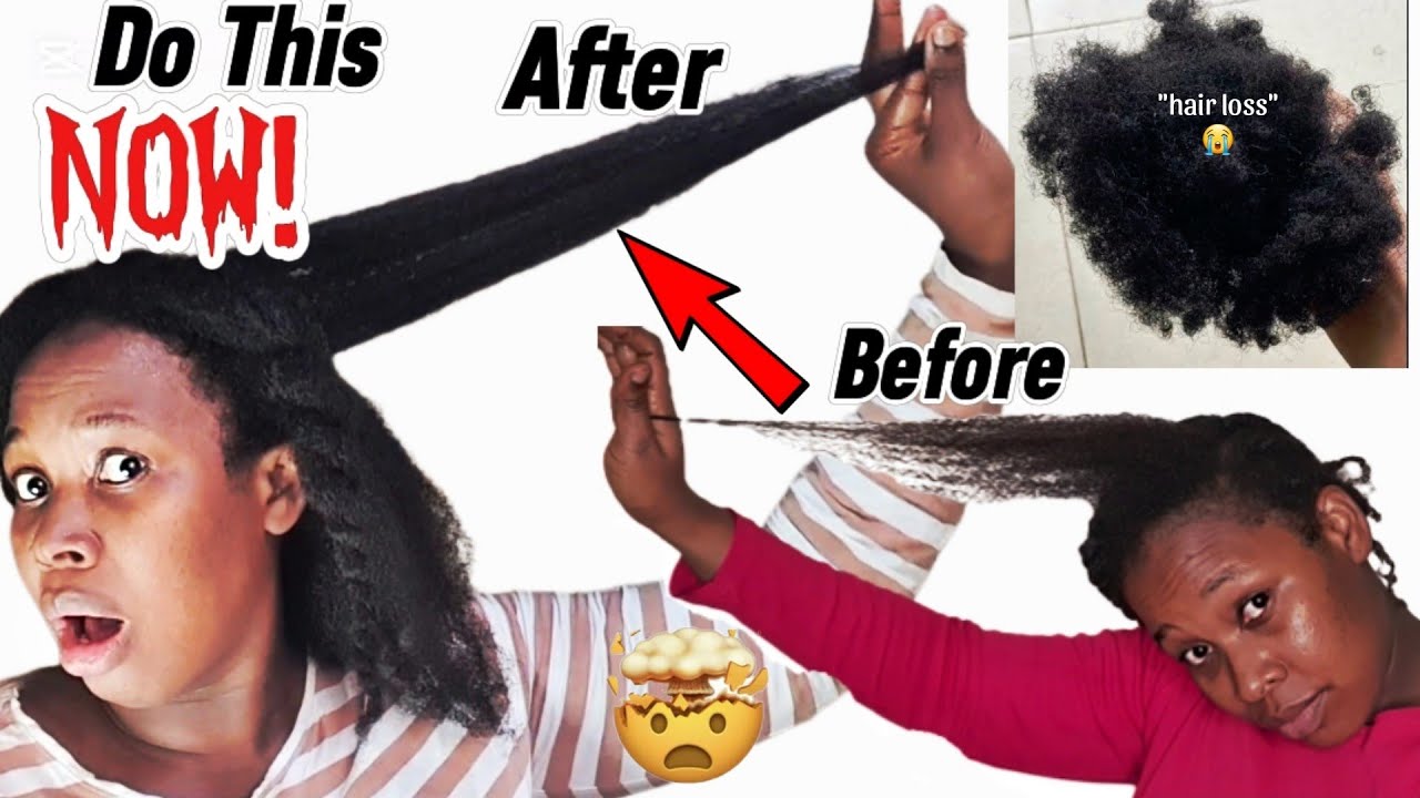 "HELP! My hair is always falling out" | How to STOP & PREVENT Hair Loss ...