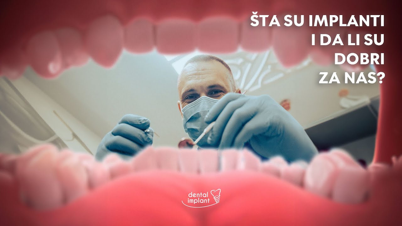 Zubni ili dentalni implanti - Dental Implant - YouTube