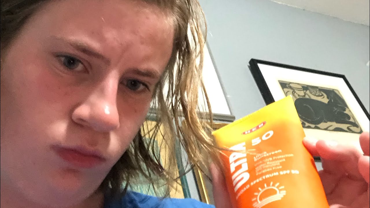 Some Tips how to get rid of a sunburn and How can you learn from it ...