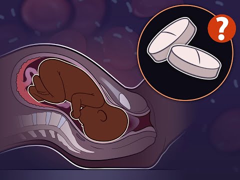 Azithromycin in Women Planning a Vaginal Birth | NEJM