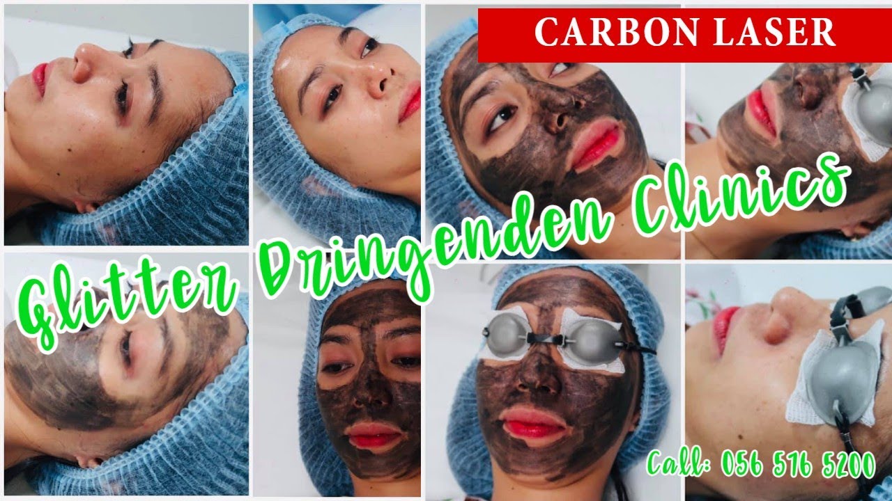Carbon Laser | GG Clinic, Abu Dhabi City | Johnlerie Serrano - YouTube