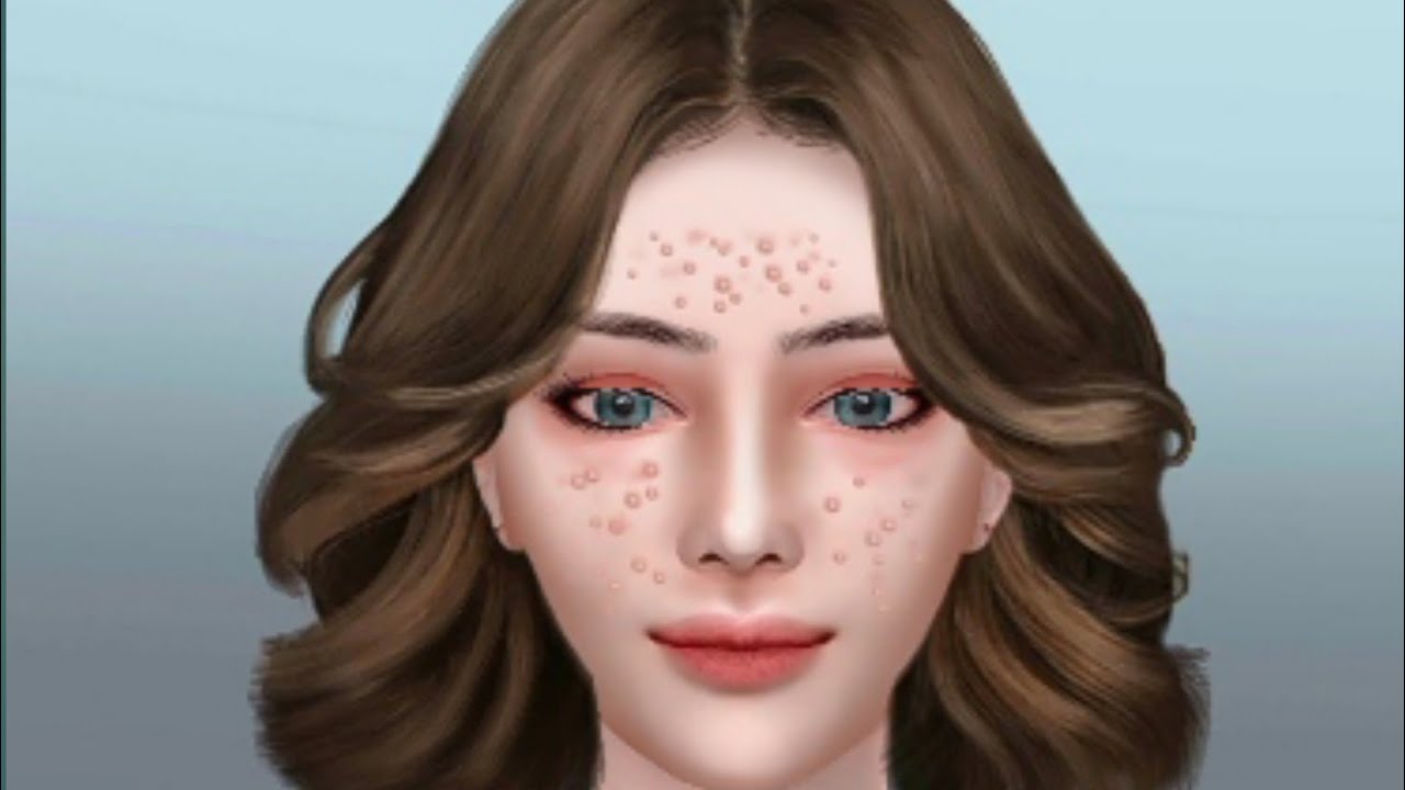 Acne Removal ASMR Spa Treatment ASMR animation // Pimple Popping ...