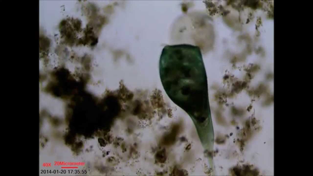 Stentor Eats Rotifer - near misses, escapes, and captures - YouTube