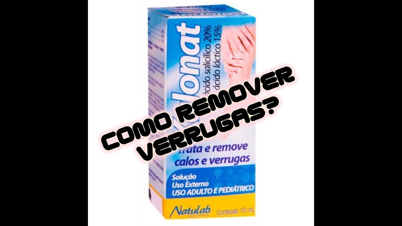 TIRANDO VERRUGAS COM KALONAT #eliminarverrugas - YouTube