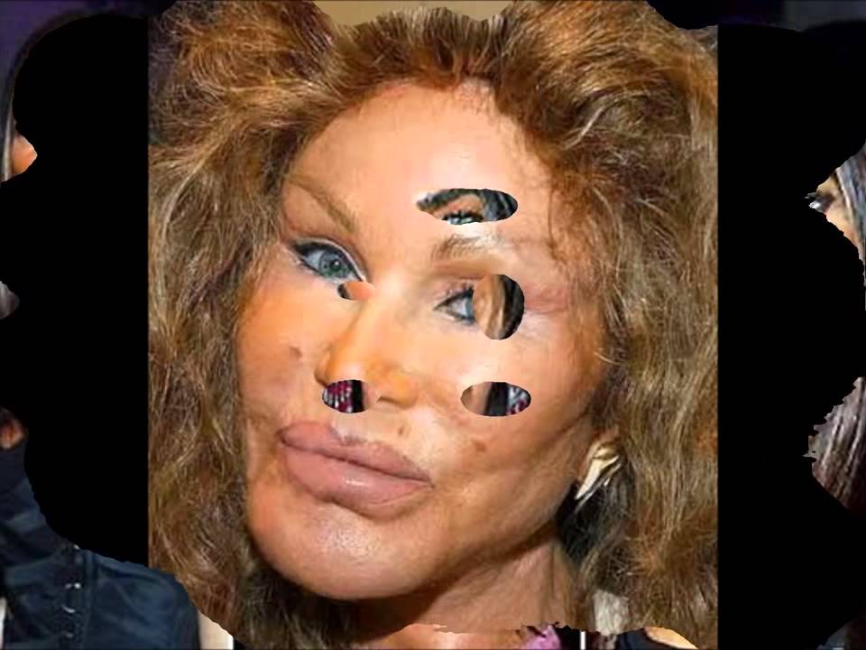 Plastic Surgery Gone Horribly Wrong Worst Plastic Surgery Ever Version ...