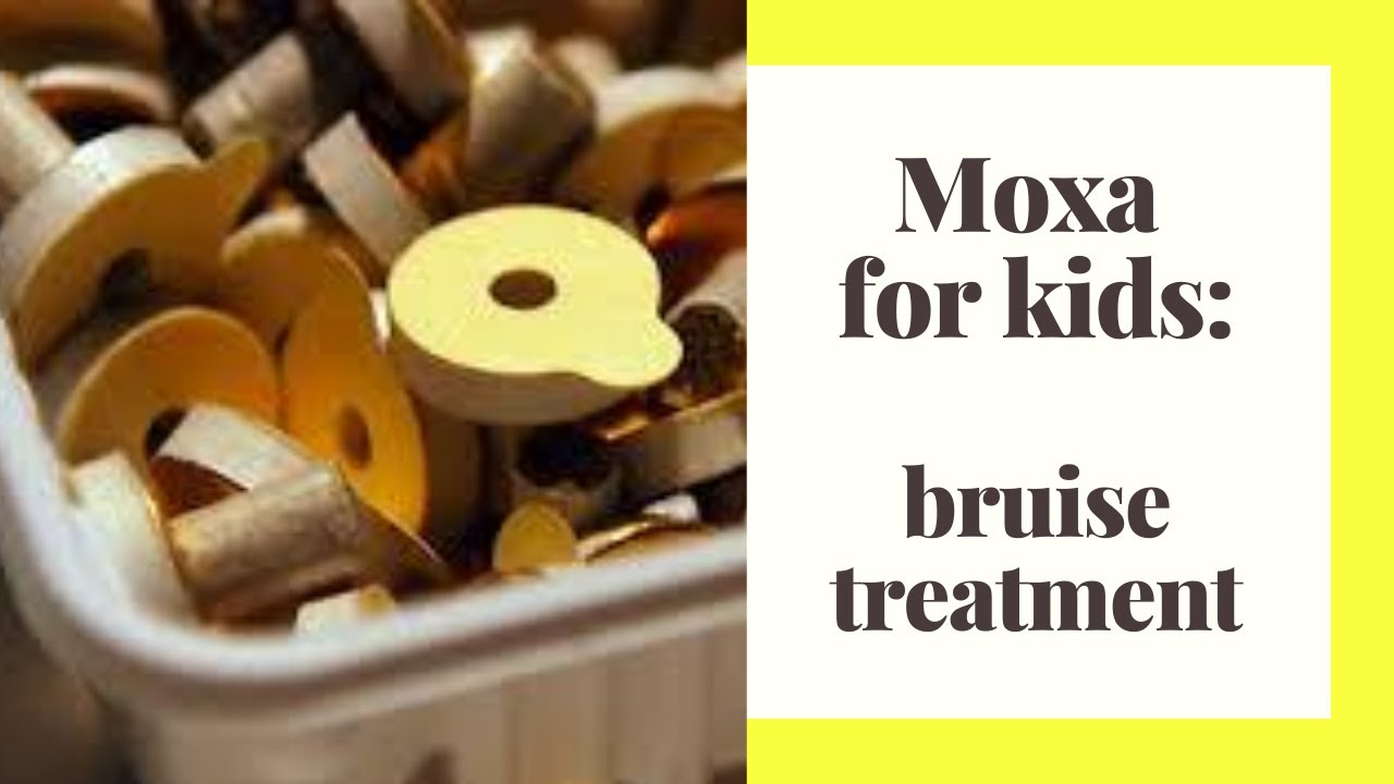 Pediatric Japanese Acupuncture In-home moxa treatment for bruises - YouTube