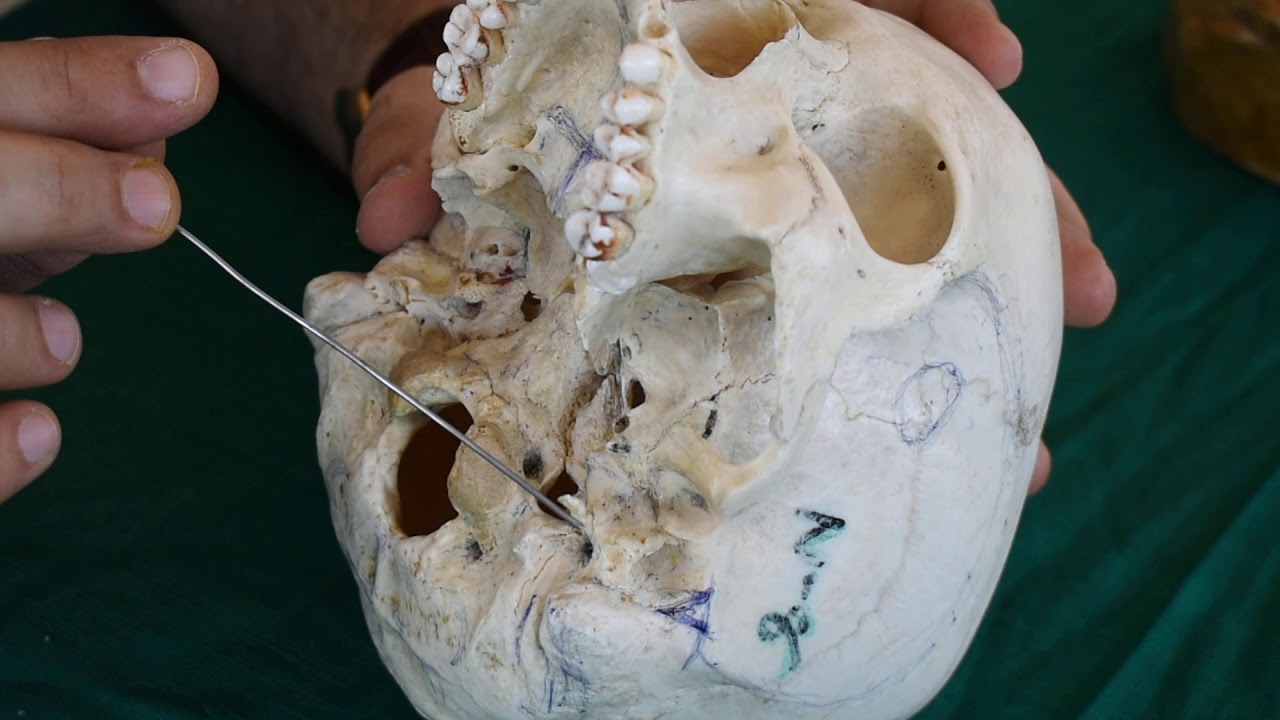 Osteology of Norma Basalis part 7 - YouTube