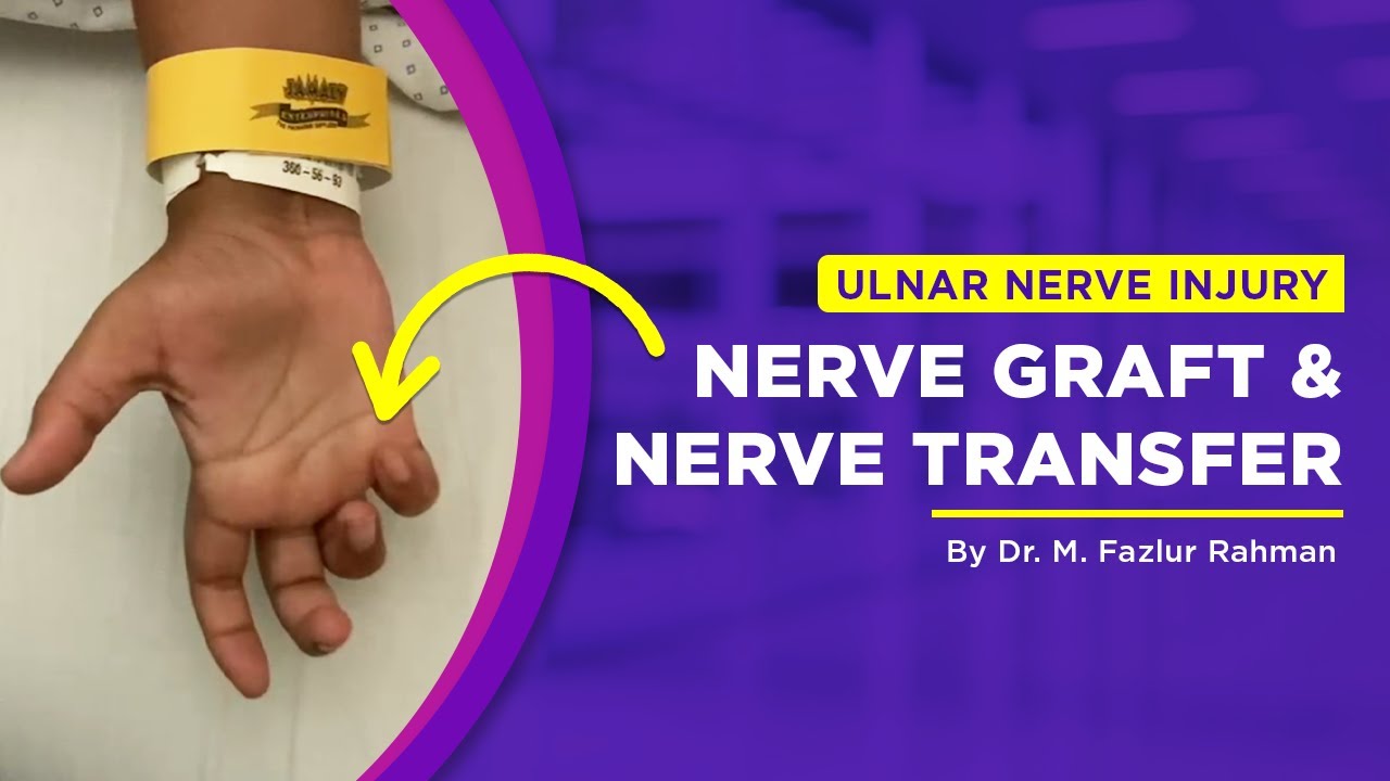 Curing Claw Hand | Nerve Graft Surgery for Ulnar Nerve Injury | Dr Fazl ...