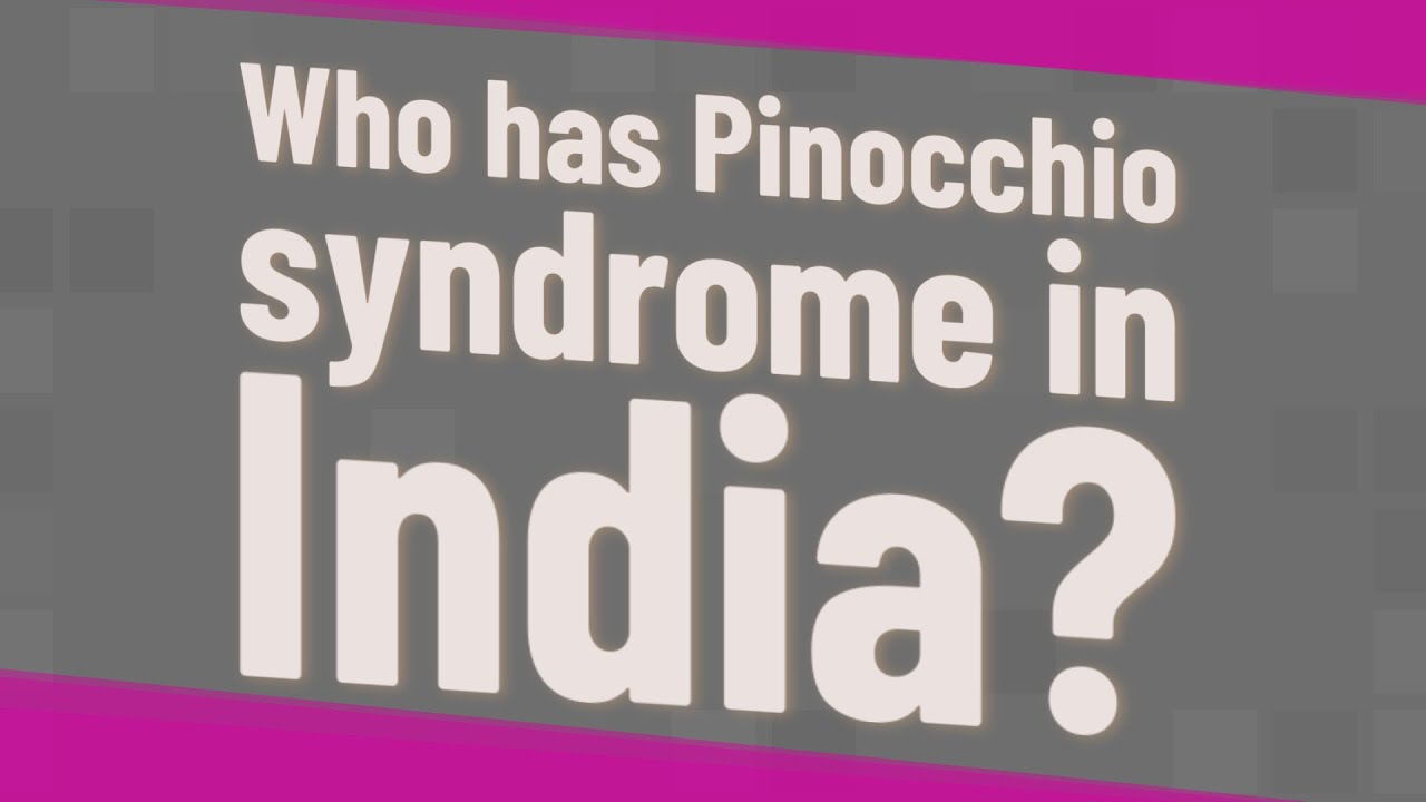 Who has Pinocchio syndrome in India? - YouTube