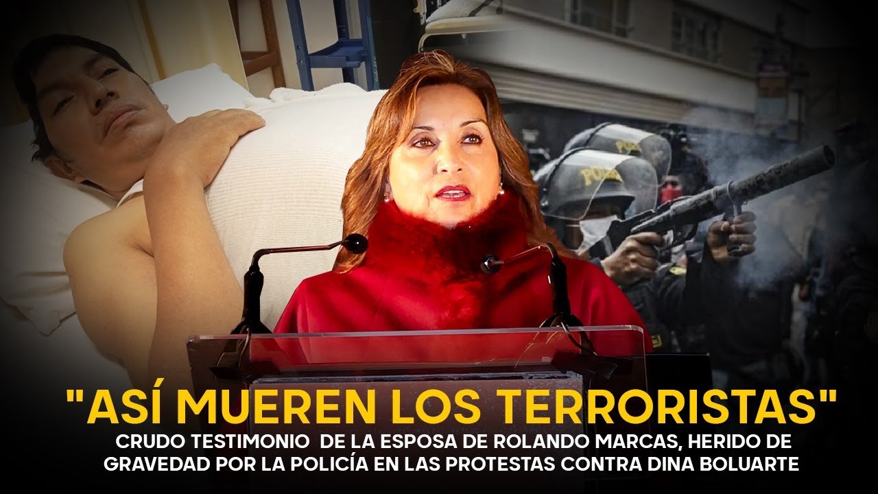 No Murió Pero Ha Quedado Sin La Mitad De Su Cráneo Más Consecuencias