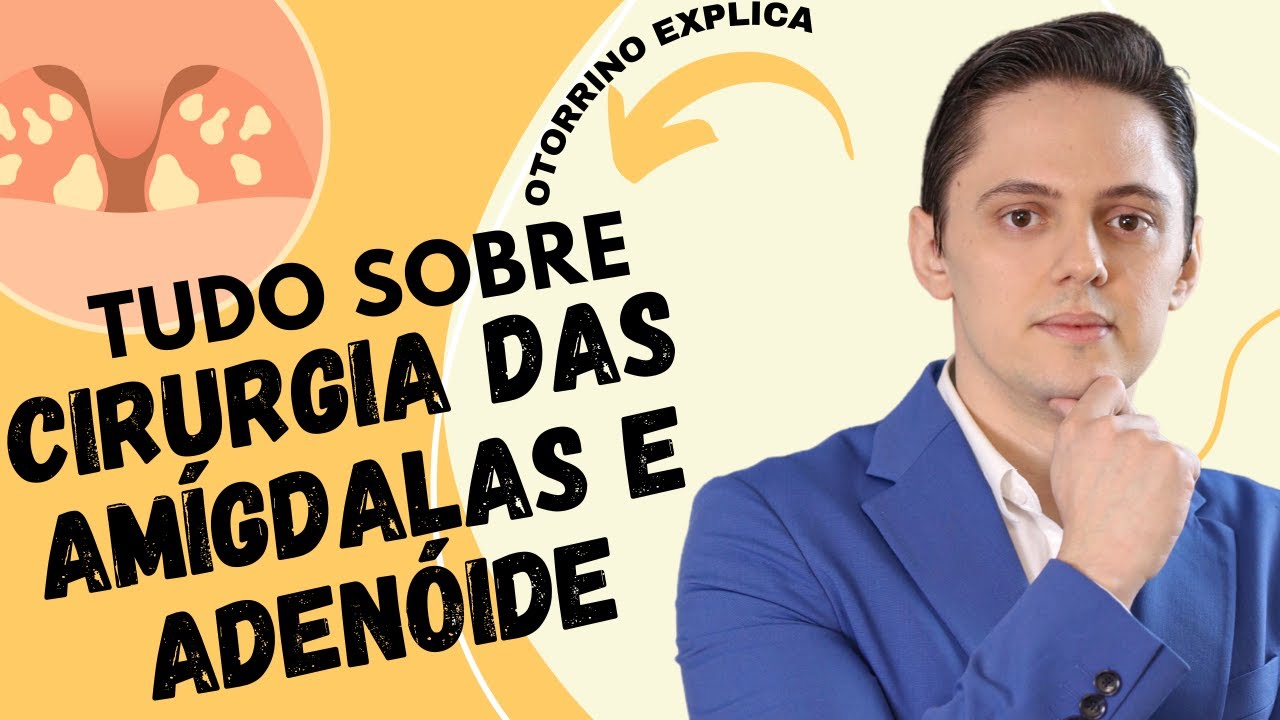 Procedimento De Amigdalectomia Passo A Passo