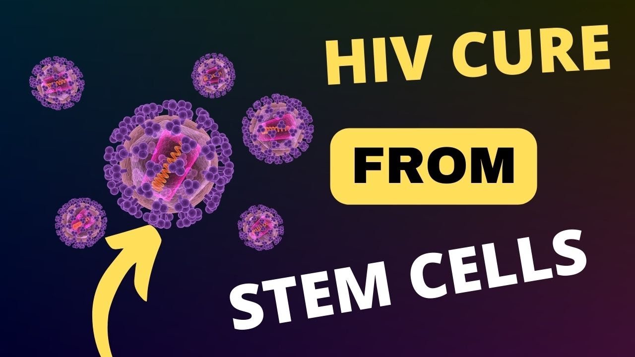 HIV cure from Stem Cells Transplant - from HIV resistant individuals ...