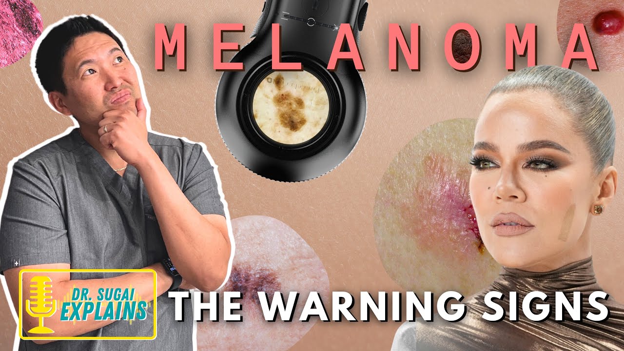 Dermatologist Explains: Warning Signs of Skin Cancer - YouTube
